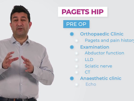 On Demand Taster Videos | Let's Talk Dr | FRCS Trauma & Orthopaedic ...