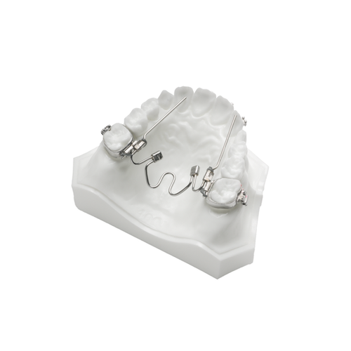 Nitanium Palatal expander 2 | Megadental