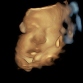 35 week scan