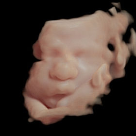 35 week 3d scan