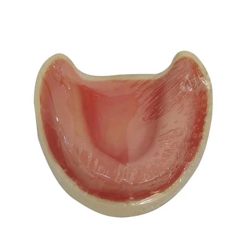 Cancellous Bone Material Model Edentulous Maxillary Dental Implant ...