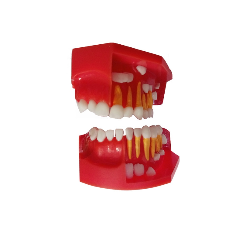 DS-S12A Dentural Development Model A (3-6 Years Old) | Dentalshop Com