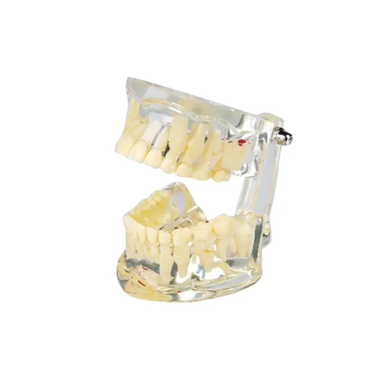 Early loss of primary teeth pathological model | Dentalshop Com