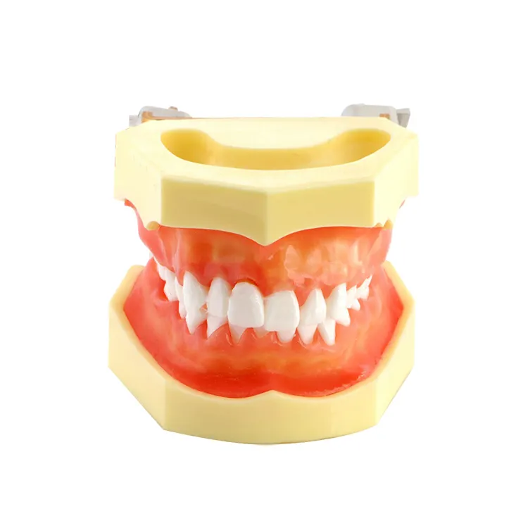 Soft Gum Mild Periodontal Dental Model Can Be Removed and Changed ...