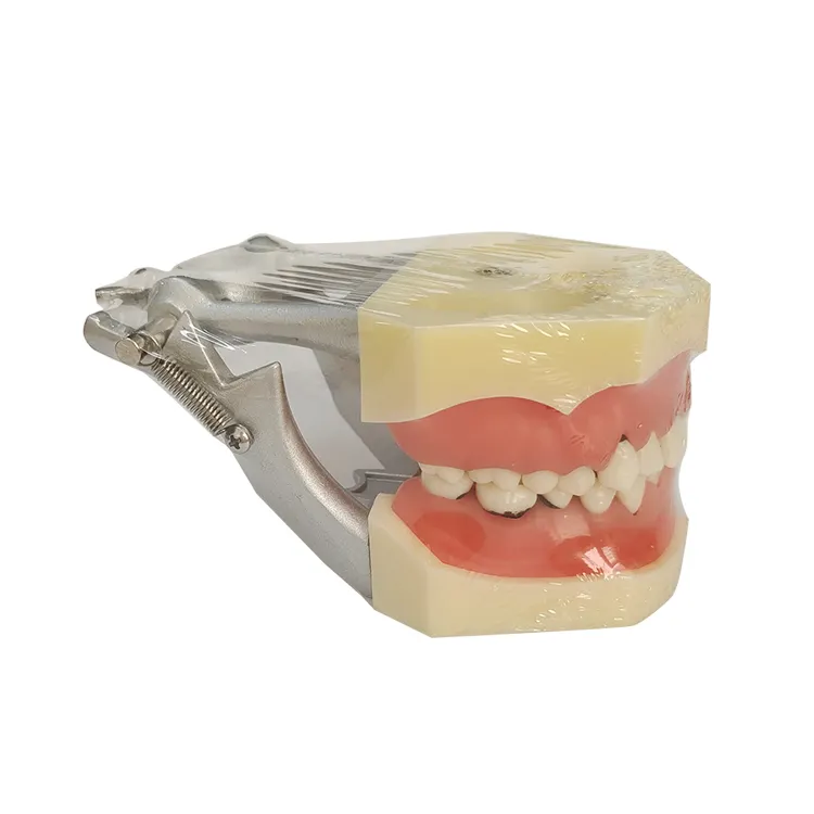 Periodontal Disease Dental Model for Demonstrating Calculus Gingivae ...