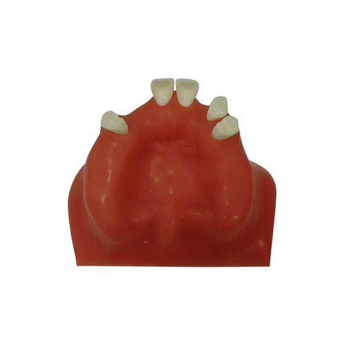 Edentulous Maxillary Bone Sinus Lift Practice Implant Model for Cutting ...