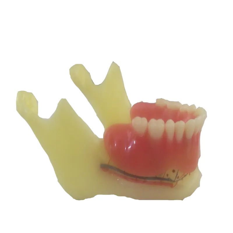 Anatomical Model of Mandible | Dentalshop Com