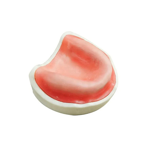 Cancellous Bone Material Model Edentulous Maxillary Dental Implant ...