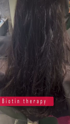 BIOTIN THERAPY transformation