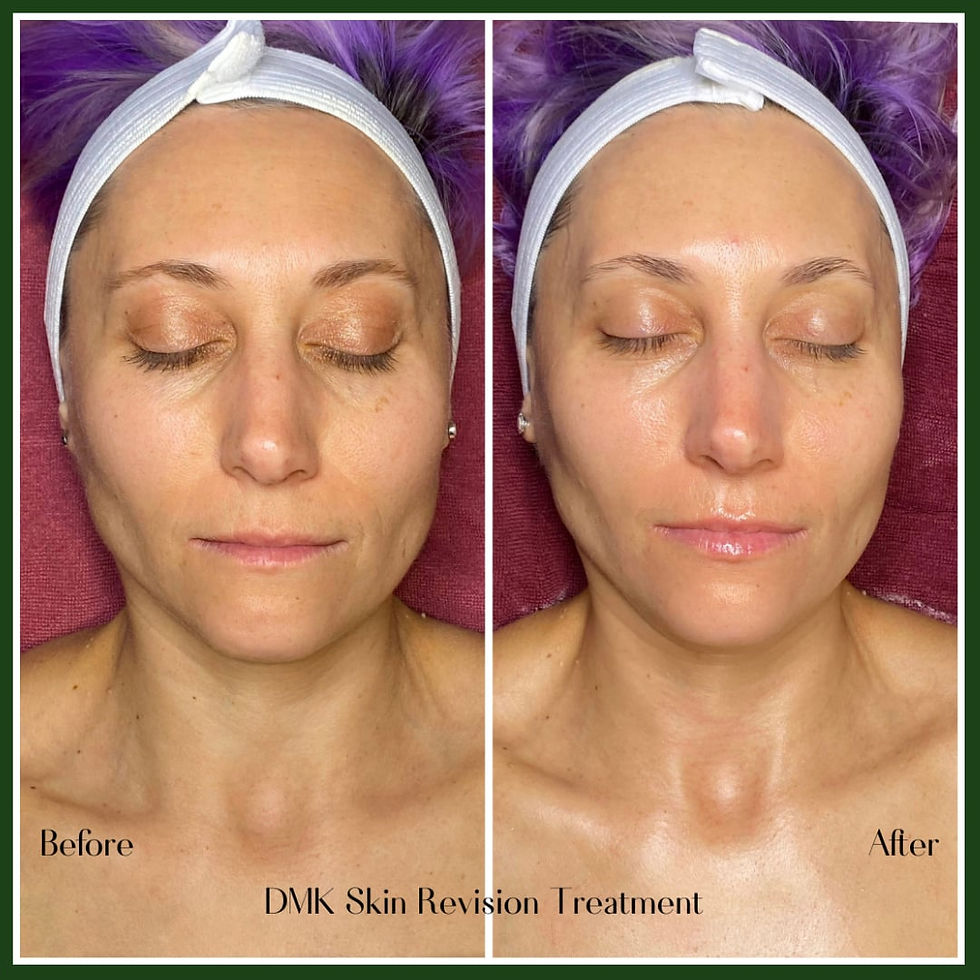 The Science Behind DMK Skin Revision Treatments: How They Transform Your Skin