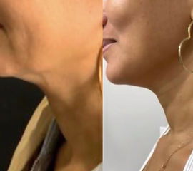 pretty faces atlanta