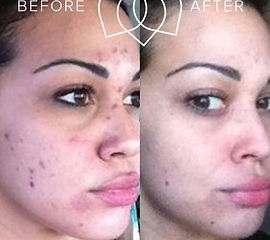 pretty faces atlanta