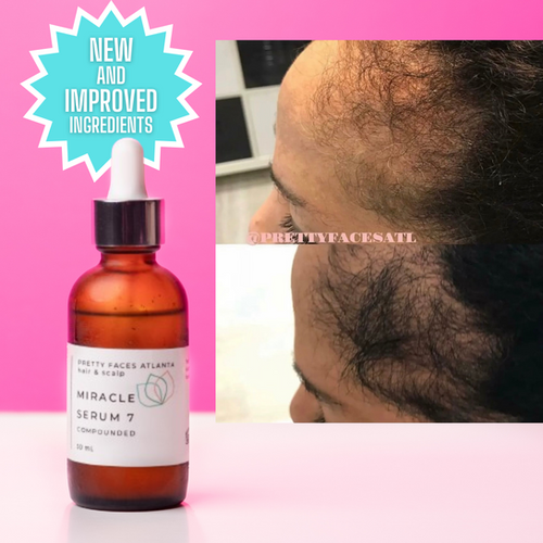 Miracle 7 Hair loss Serum - 7% Compounded Minoxidil | Prettyfacesatlanta