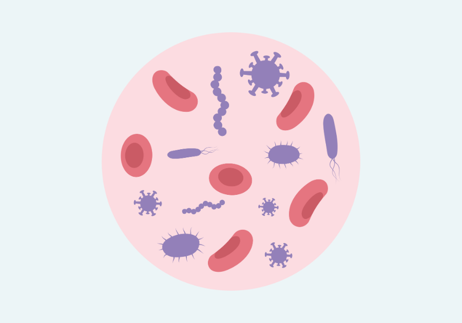 Viktigt att veta om sepsis (blodförgiftning): orsak och symtom | Läka ...