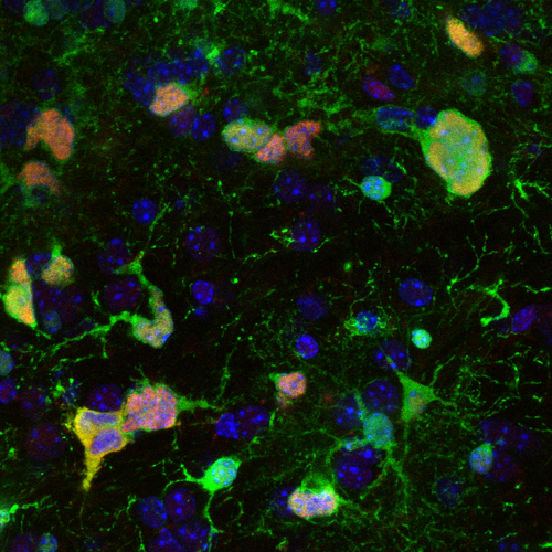 Verdon Taylor Lab - Departement Biomedicine | Verdontaylorlab | Basel