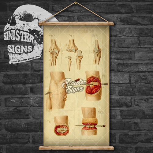 Forearm Amputation Wall Hanging | Sinister Signs