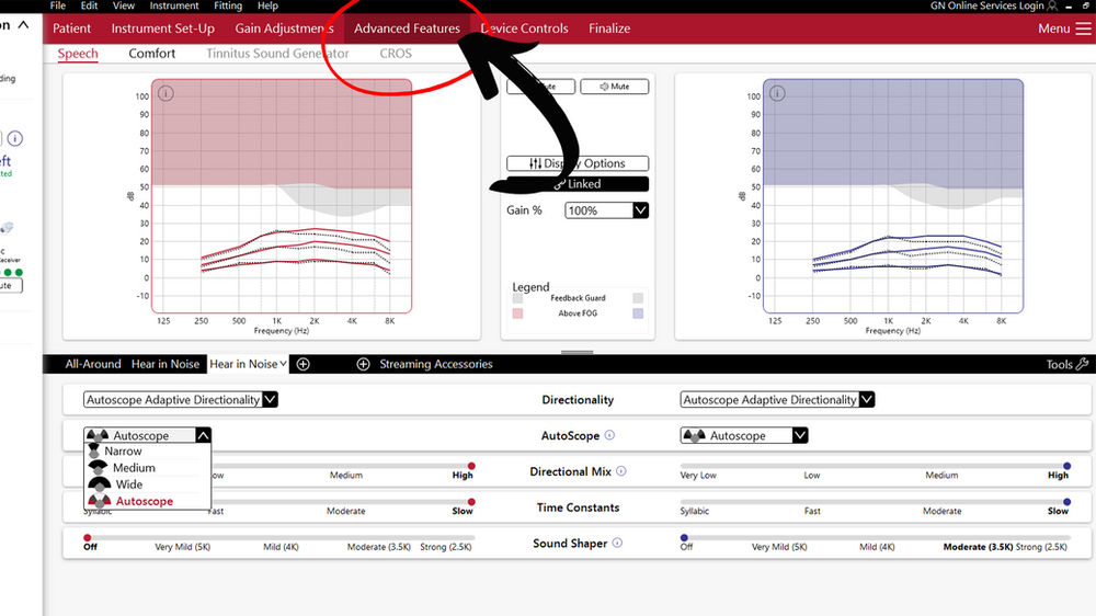 How To Add Front Focus Cone | Hearing Club