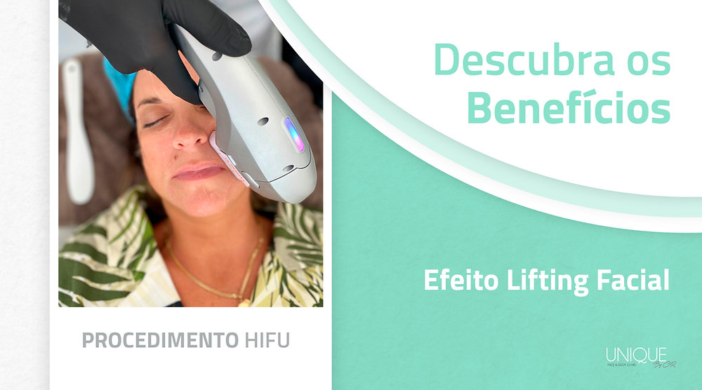 Procedimento HIFU: Descubra os Benefícios do HIFU para o Efeito Lifting ...
