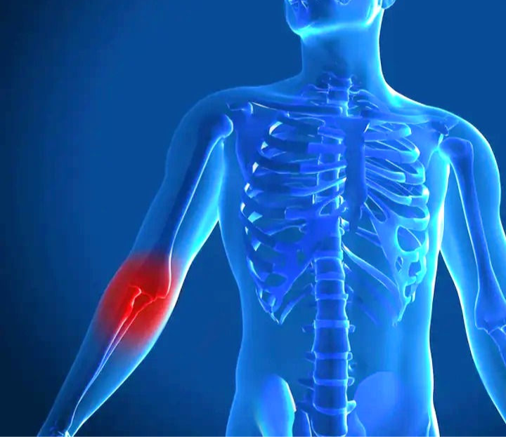 Elbow X-Rays | The Radiology Clinic