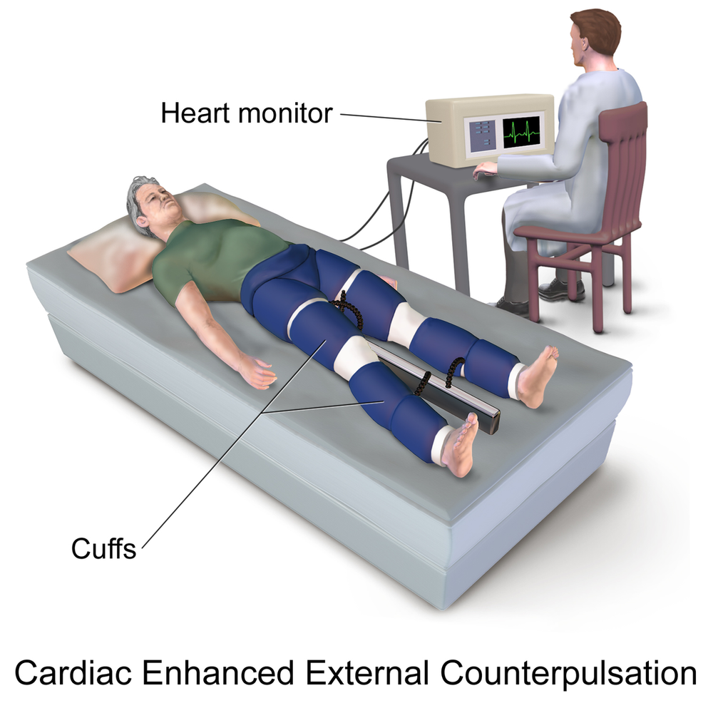 Discover EECP - The Natural Bypass