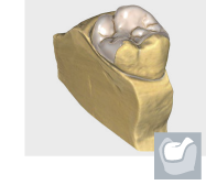 3D Center | exocad DentalCAD