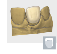 3D Center | exocad DentalCAD