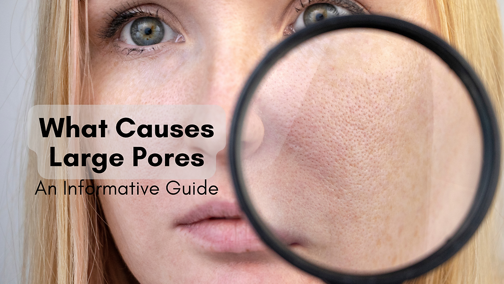 What Causes Large Pores? An Informative Guide