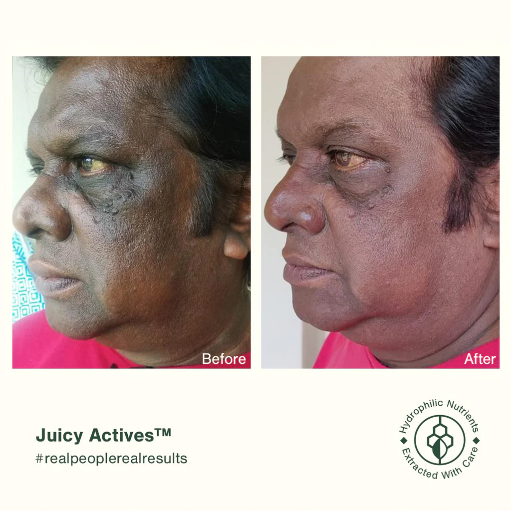 Hyperpigmentation & Scar Healing Kit | Buddh - Awaken to Ayurveda