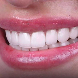 Tulip Dent - Dental Clinics in Turkey