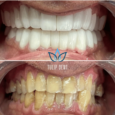 Tulip Dent - Dental Clinics in Turkey