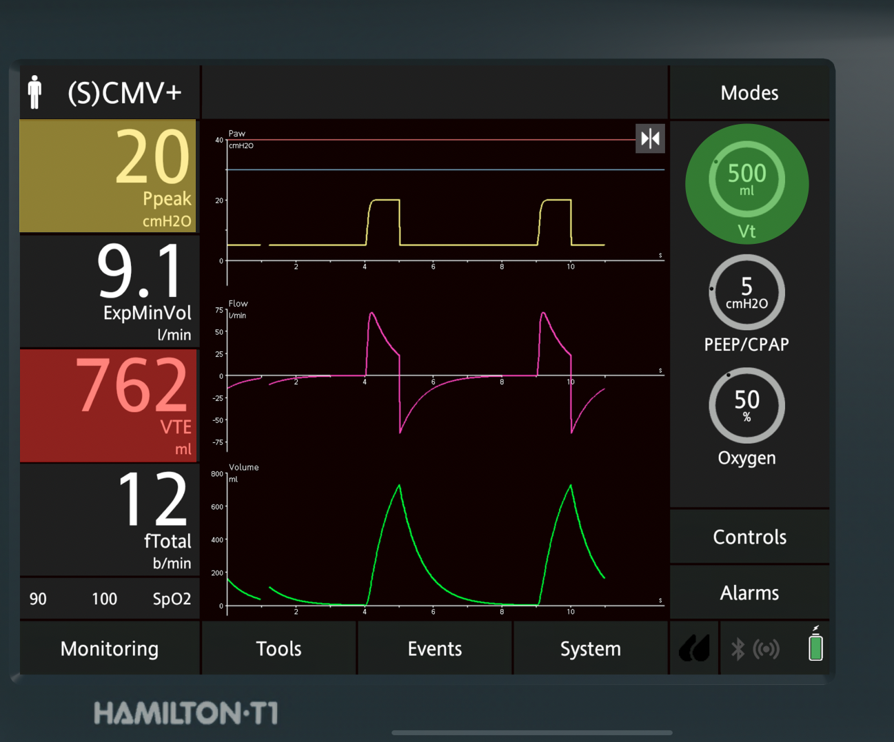Difference Between CMV and SIMV