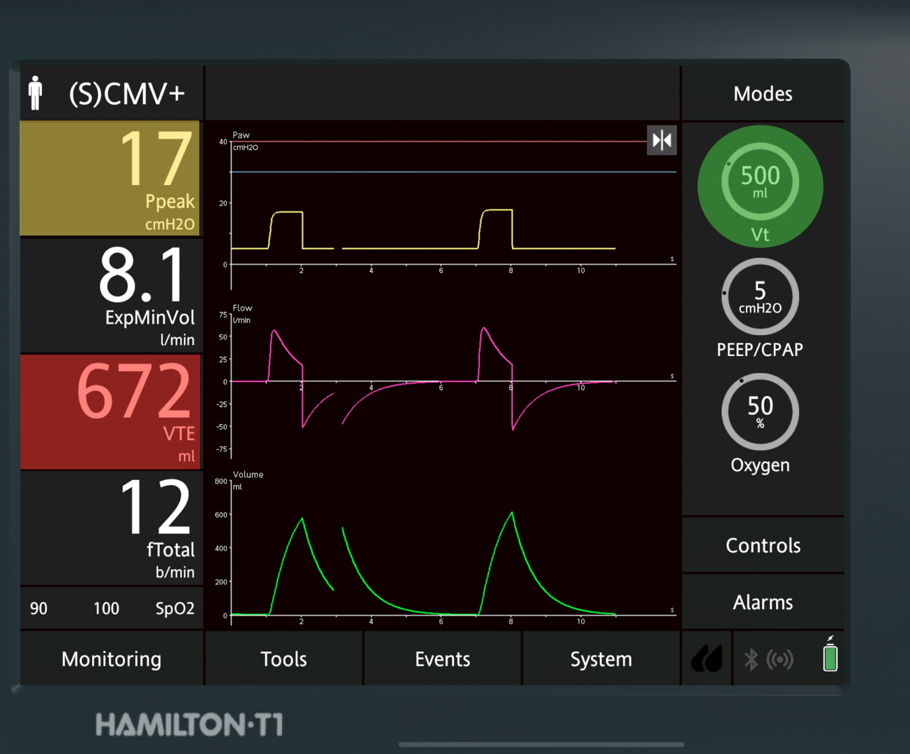 Difference Between CMV and SIMV