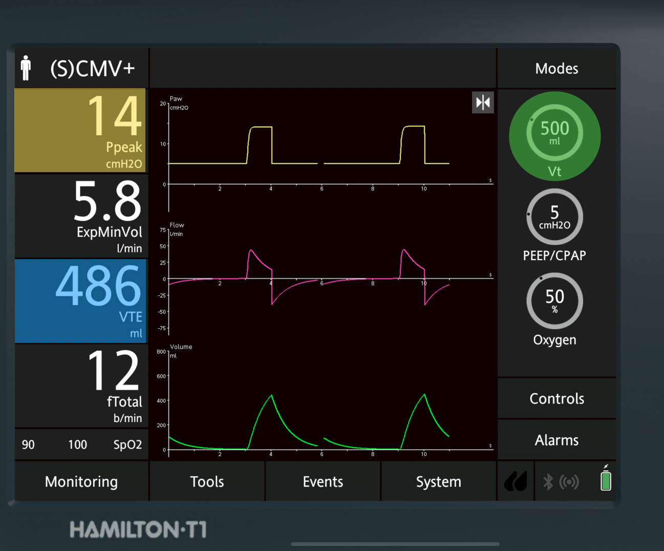 Difference Between CMV and SIMV