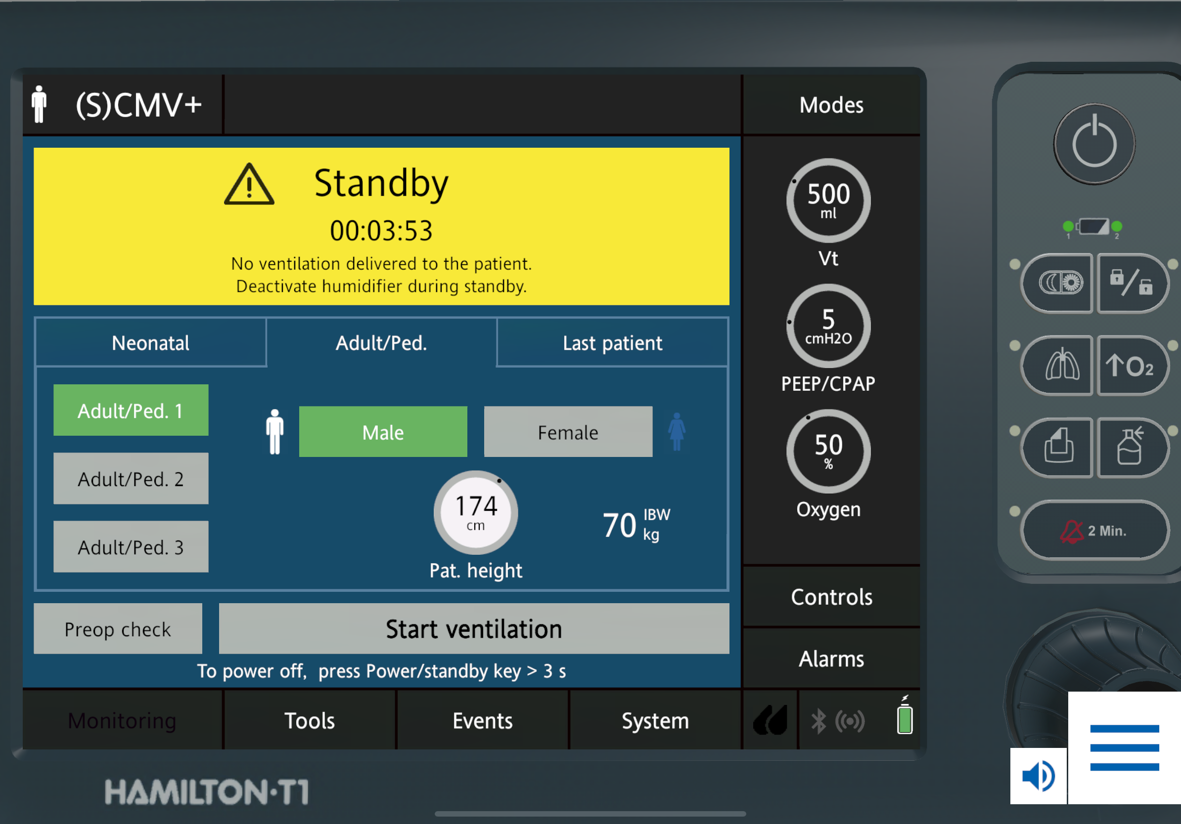 Difference Between CMV and SIMV