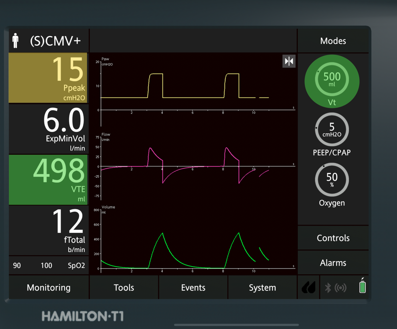 Difference Between CMV and SIMV