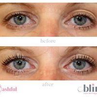Lash Extensions | Blink