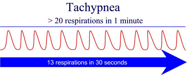 HYPERVENTILATION VS TACHYPNEA VS HYPERPNEA