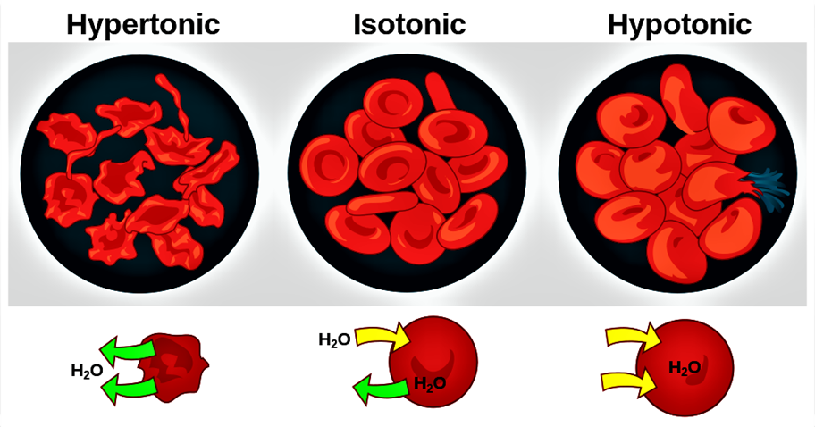Methods of adjusting isotonicity: Class I | Class II | White-Vincent ...