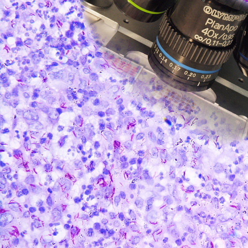 Acid fast staining | quickarrays