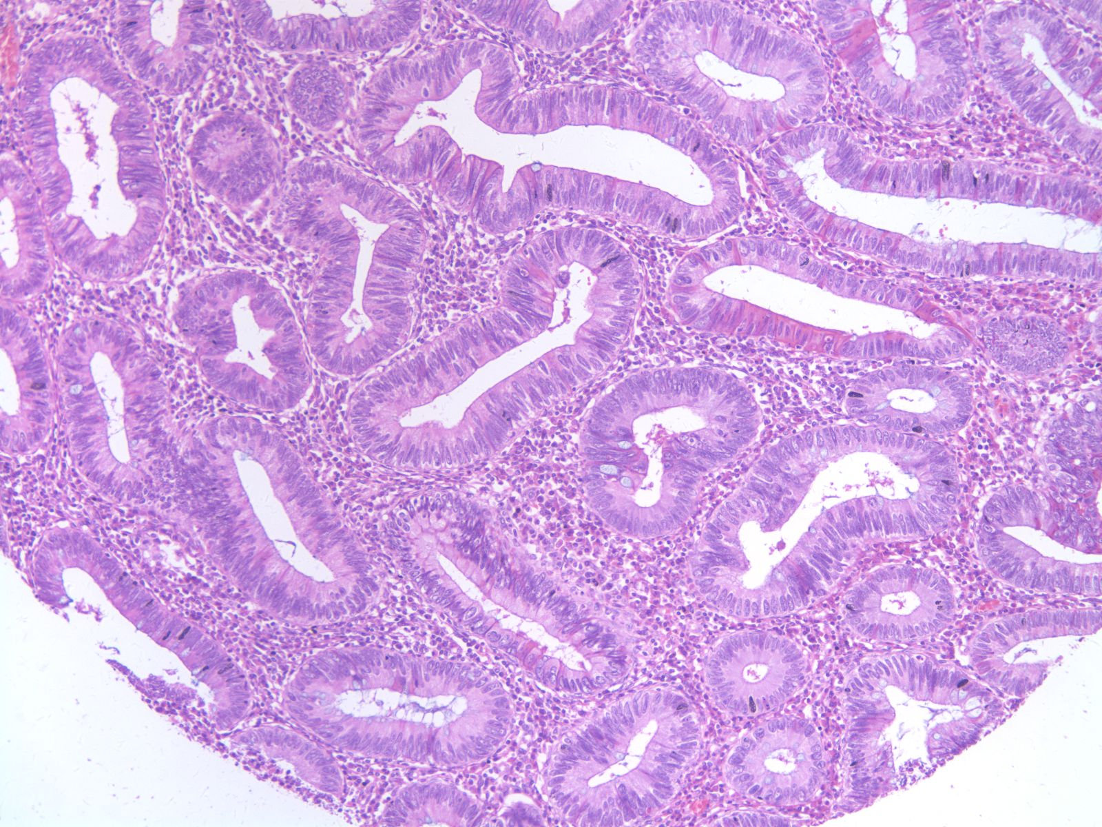 COC1261Tissue Micro Arrays
