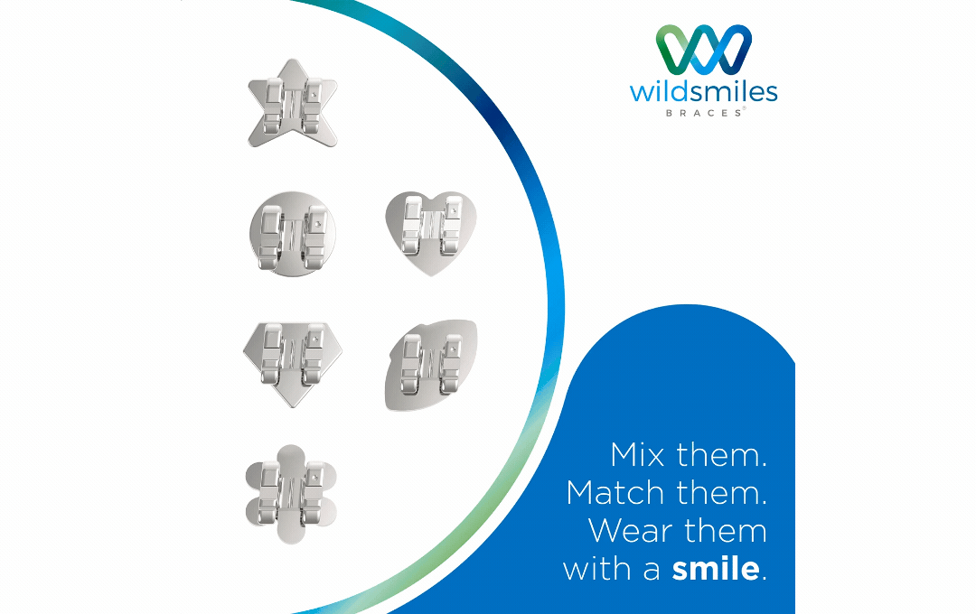 Unleash Your Style with Wild Smiles Brackets at Lazzara Smiles