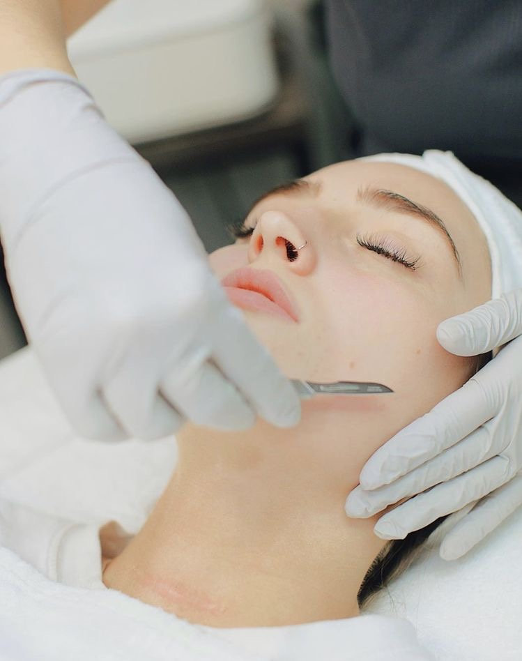 What Are The Benefits Of A Dermaplane Facial?
