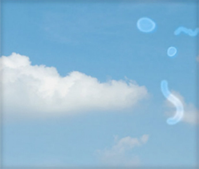 Ask the Expert: What are floaters?