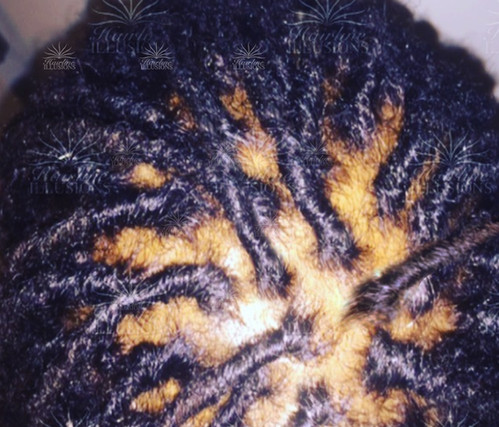 Dreadlock Readymade Scalp Replacement Cranial Prosthesis Topper ...