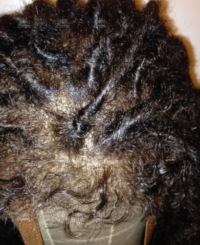 Soft Jumbo Dreadlock Scalp Replacement with HD Lace Front | Hairline ...