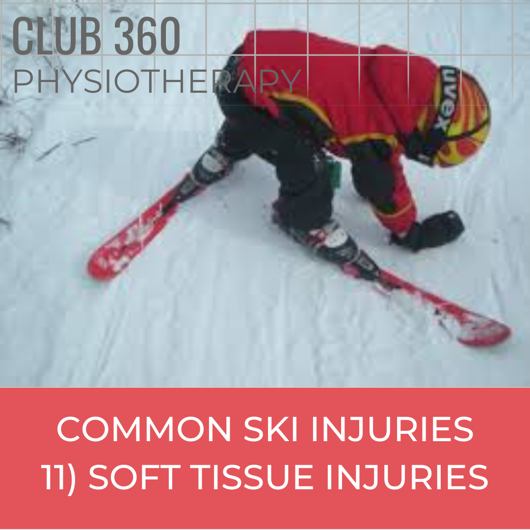 Common Ski Injuries #11: Soft tissue injuries
