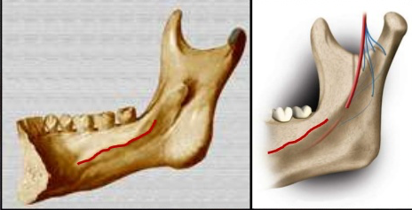 Reborde milohioideo o Línea Oblicua Interna | mandibularx