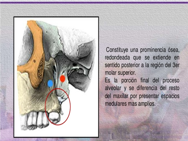 Tuberosidad del maxilar