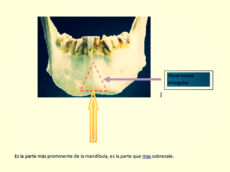 Prominencia mentoniana (eminencia mentoniana/reborde mentoniano ...
