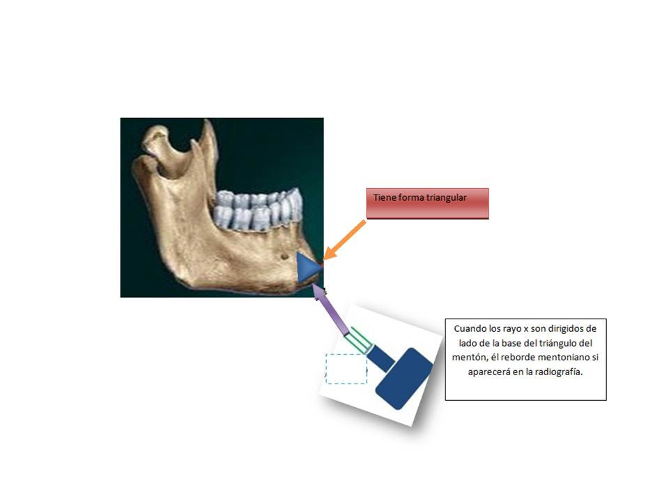 Prominencia mentoniana (eminencia mentoniana/reborde mentoniano)